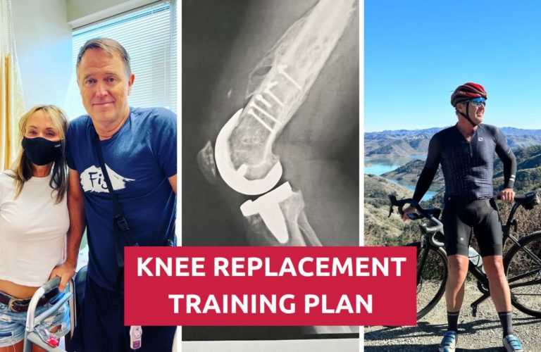 Knee Replacement Training Plan: Returning to Cycling and Sport after ...